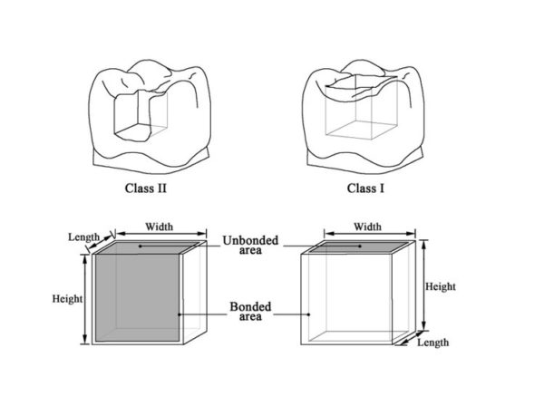 factor+c+composite | Dental Tonal