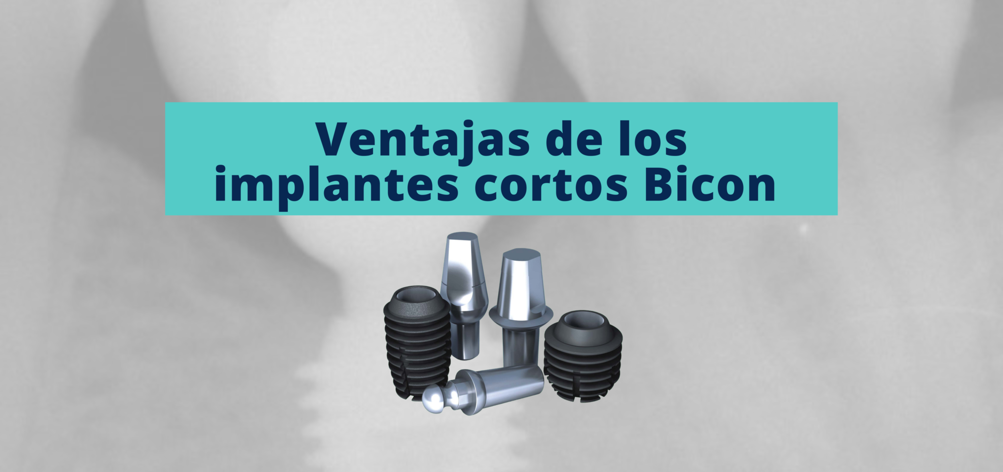 Ventajas implantes cortos Bicon | Dental Tonal